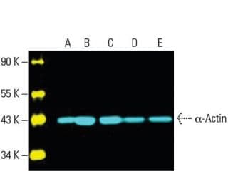 α-Actin Antibody (1A4) | SCBT - Santa Cruz Biotechnology