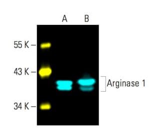 ARG1/Arginase 1抗体 (E-2) | SCBT - Santa Cruz Biotechnology