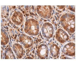 ASC/TMS1/PYCARD Antibody (B-3) | SCBT - Santa Cruz Biotechnology
