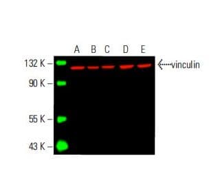 vinculin Antibody (7F9) | SCBT - Santa Cruz Biotechnology