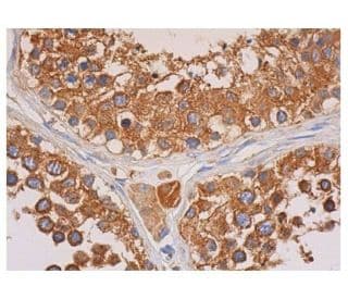 WT1 Antibody (H-1) | SCBT - Santa Cruz Biotechnology